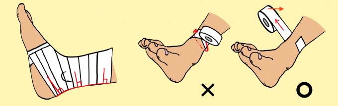 アスレティックトレーナー（JSPO-AT）として必要なスキルを実技試験から読み解く！～part8～テーピング